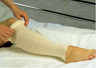 Stockinette Tubular Albahealth® 3 Inch X 25 Yard Cotton NonSterile ...