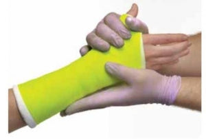 Delta-Lite Conformable Fiberglass Cast | Gilgal Medical Supplies Inc