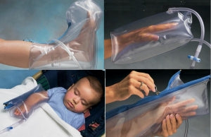 Urias Air Splints | Gilgal Medical Supplies Inc