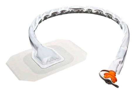 Stand Alone Soft Port Kit Renasys – Gilgal Medical Supplies Inc